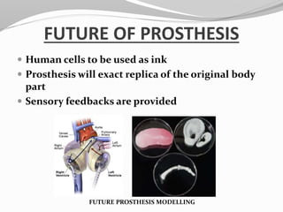 Bioelectric Prosthesis Modelling using 3D-Printing | PPTX