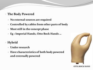 Bioelectric Prosthesis Modelling using 3D-Printing | PPTX