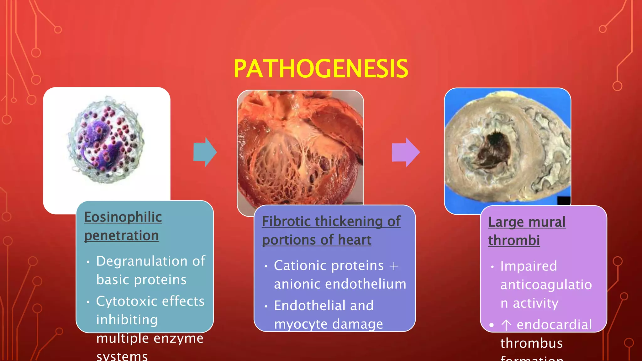 Loefflers Endocarditis | PPTX