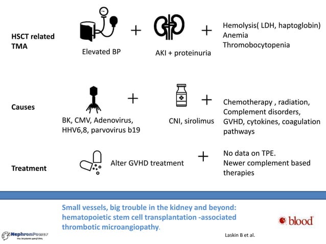 HSCT-TMA | PPT