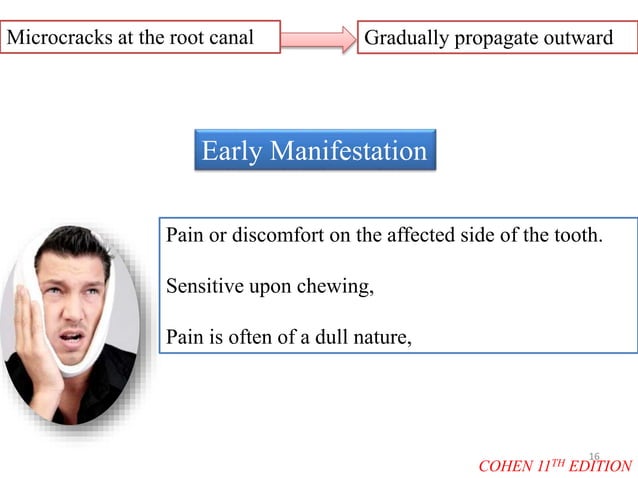 vertical root fracture and it's management ..... | PPTX | Dental Health ...