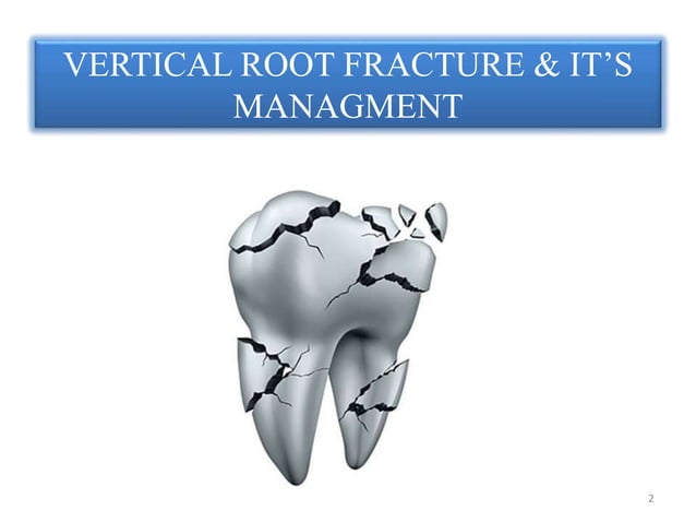 vertical root fracture and it's management ..... | PPTX | Dental Health ...