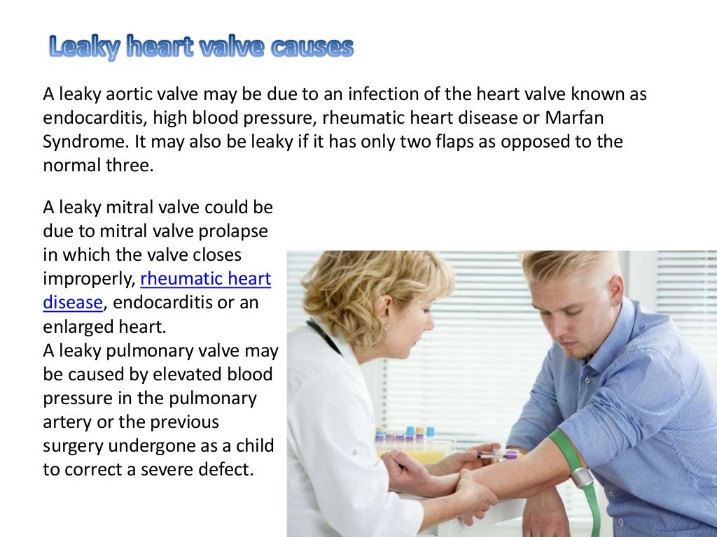 Leaky Heart Valve Symptoms Causes And Treatments leaky-heart-valve-symptoms-causes-and-treatments