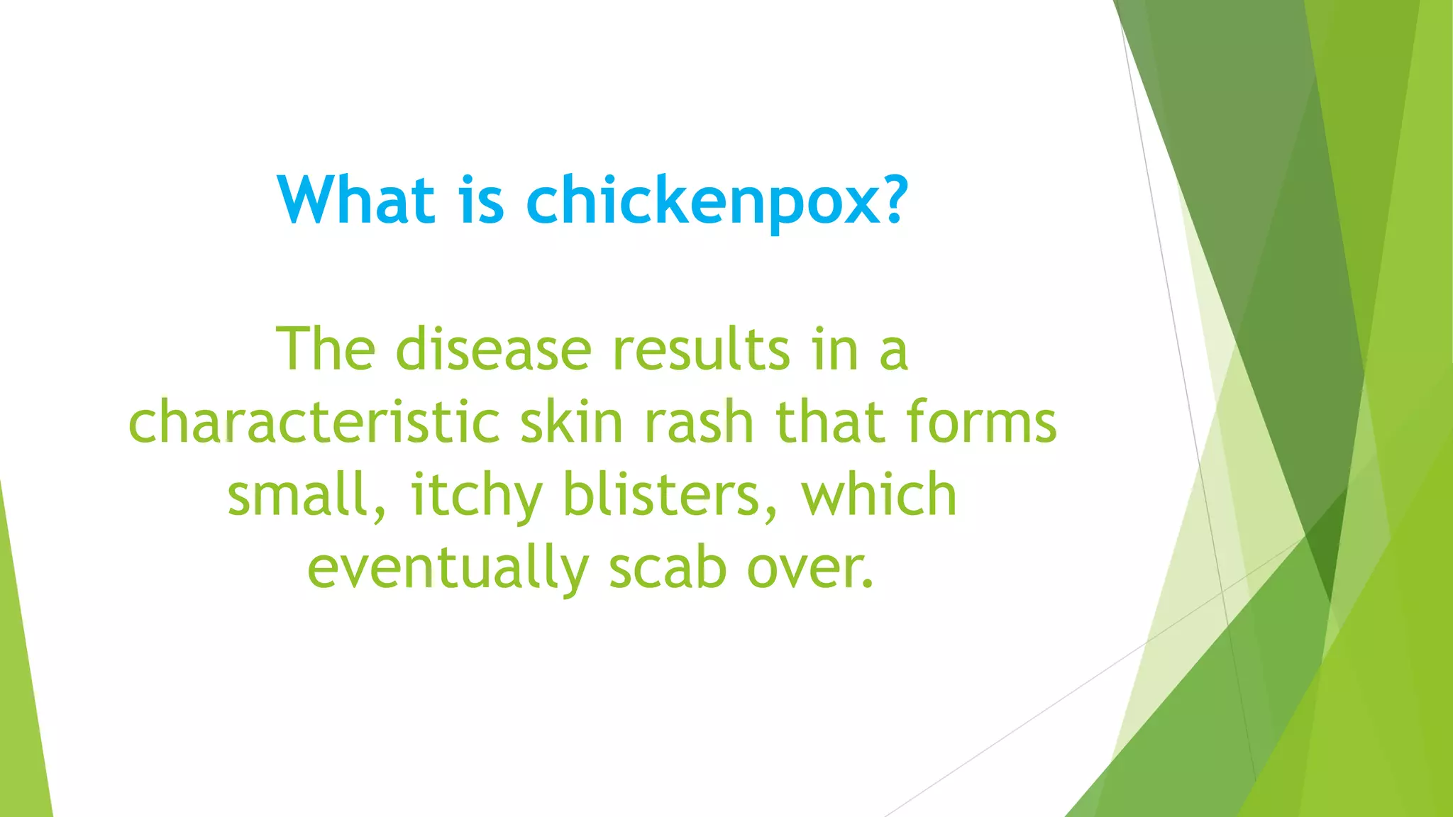Chickenpox | PPT