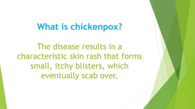Chickenpox | PPT