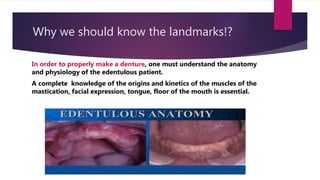 Presentation (1) of anatomical landmark of maxilla and mandible | PPTX