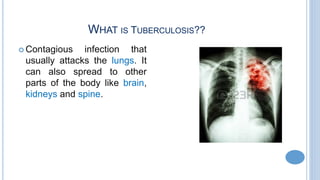 Mycobacterium tuberculosis | PPTX