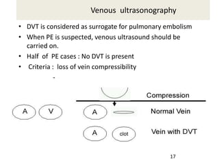 deep vein thrombosis and pe | PPTX