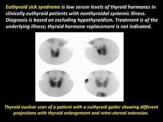 Presentation1.pptx, radiological imaging of the thyroid gland diseases ...