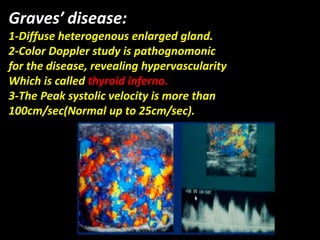 Presentation1.pptx, radiological imaging of the thyroid gland diseases ...