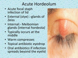 CAUSES AND MANAGEMENT OF RED EYES | PPT