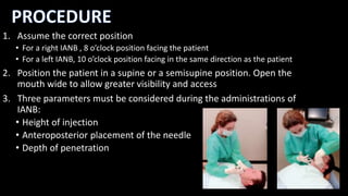 INFERIOR ALVEOLAR NERVE BLOCK | PPTX