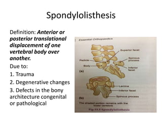 spondylo listhesis | PPTX