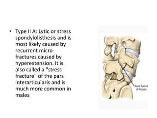 spondylo listhesis | PPTX