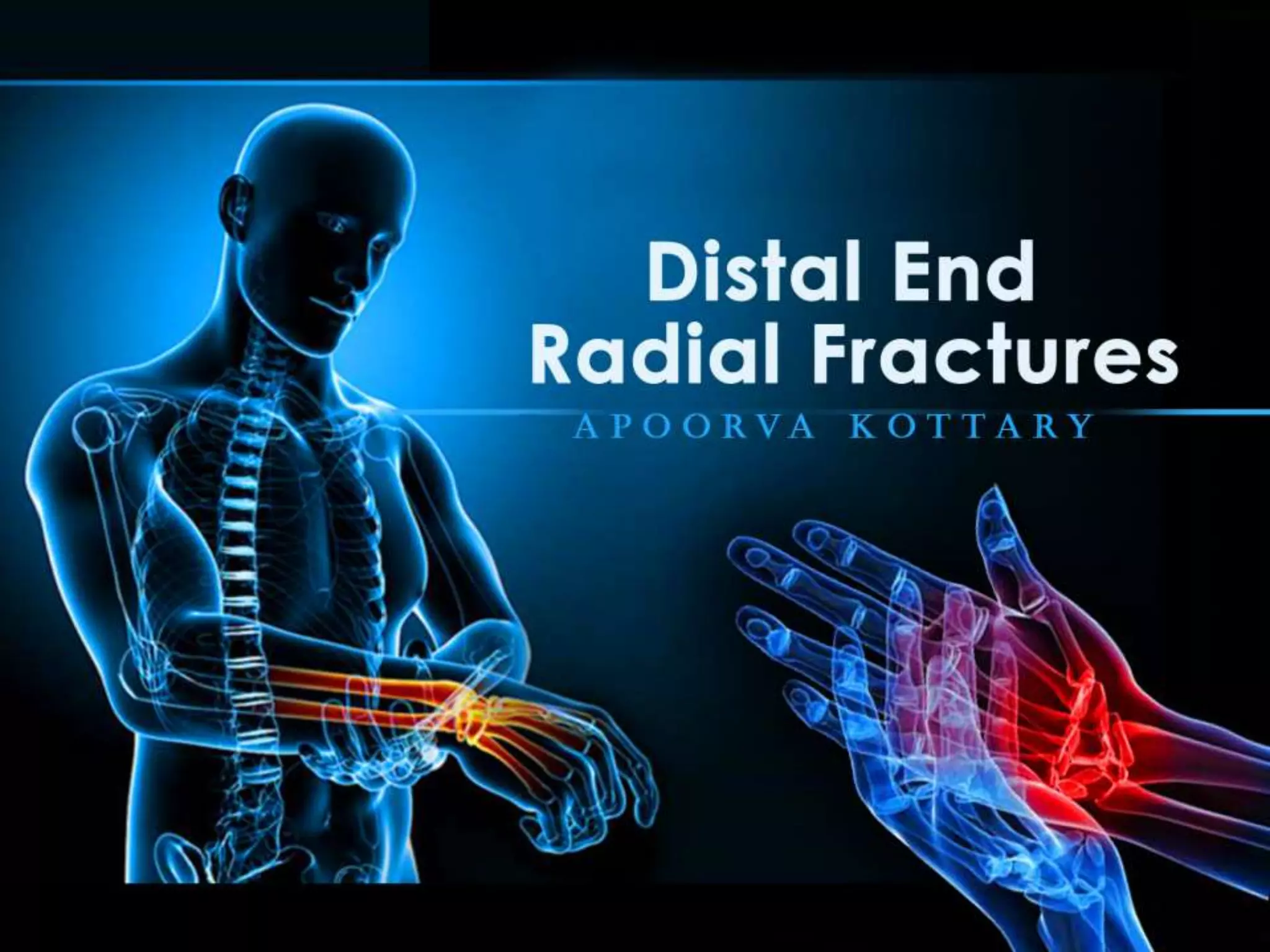 Distal End Radius Fractures - Colles, Smiths & Bartons | PPTX