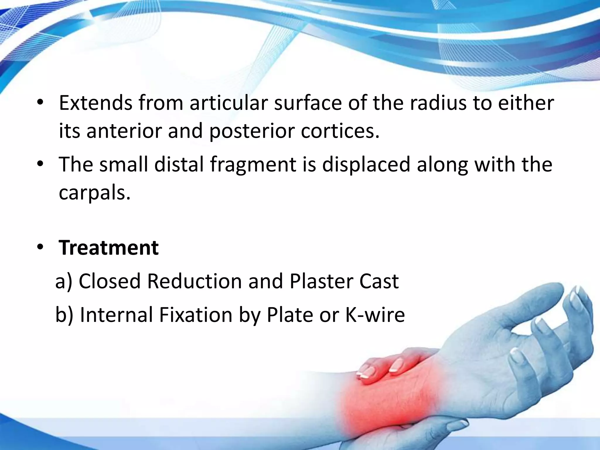 Distal End Radius Fractures - Colles, Smiths & Bartons | PPTX