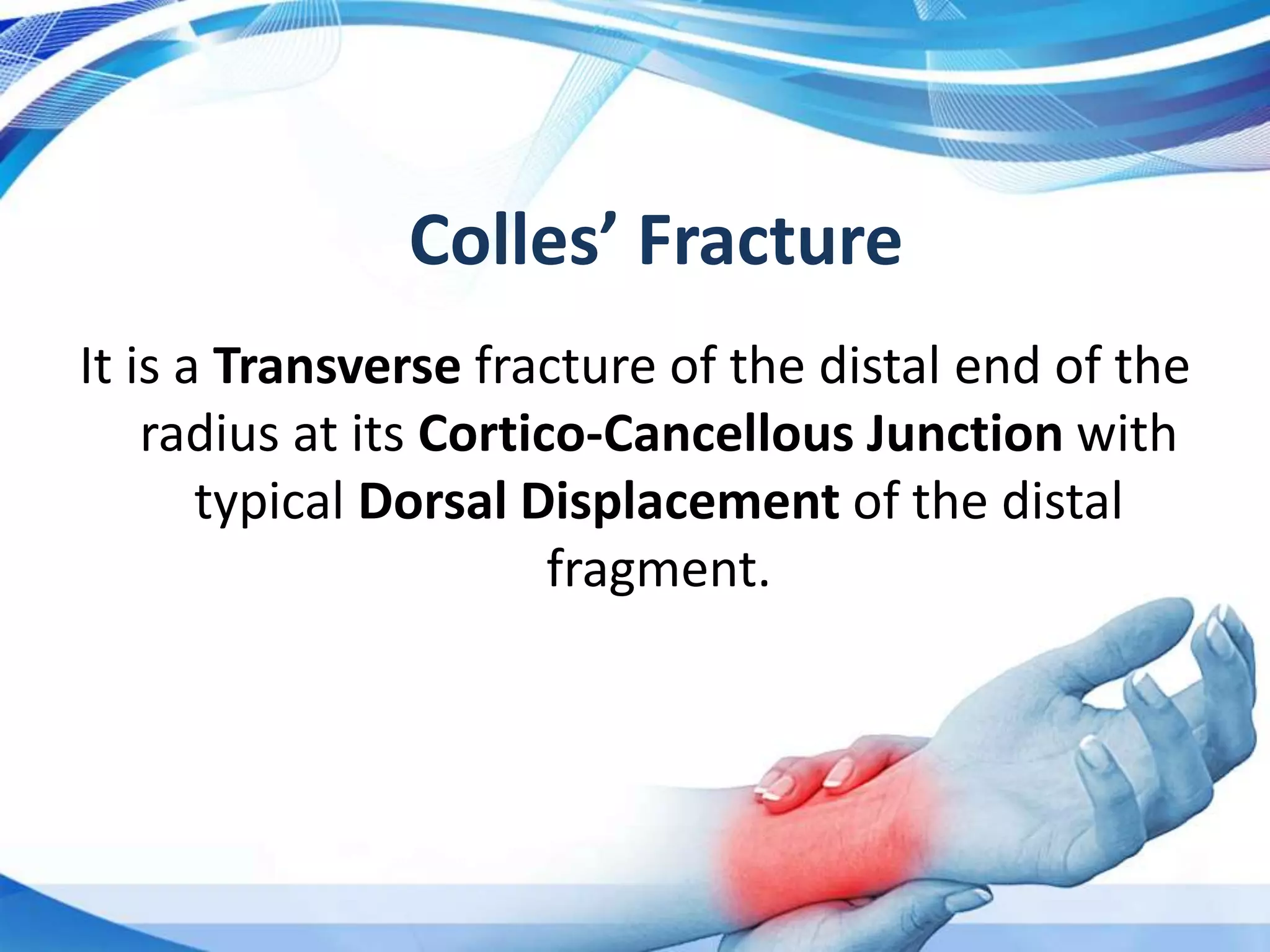 Distal End Radius Fractures - Colles, Smiths & Bartons | PPTX