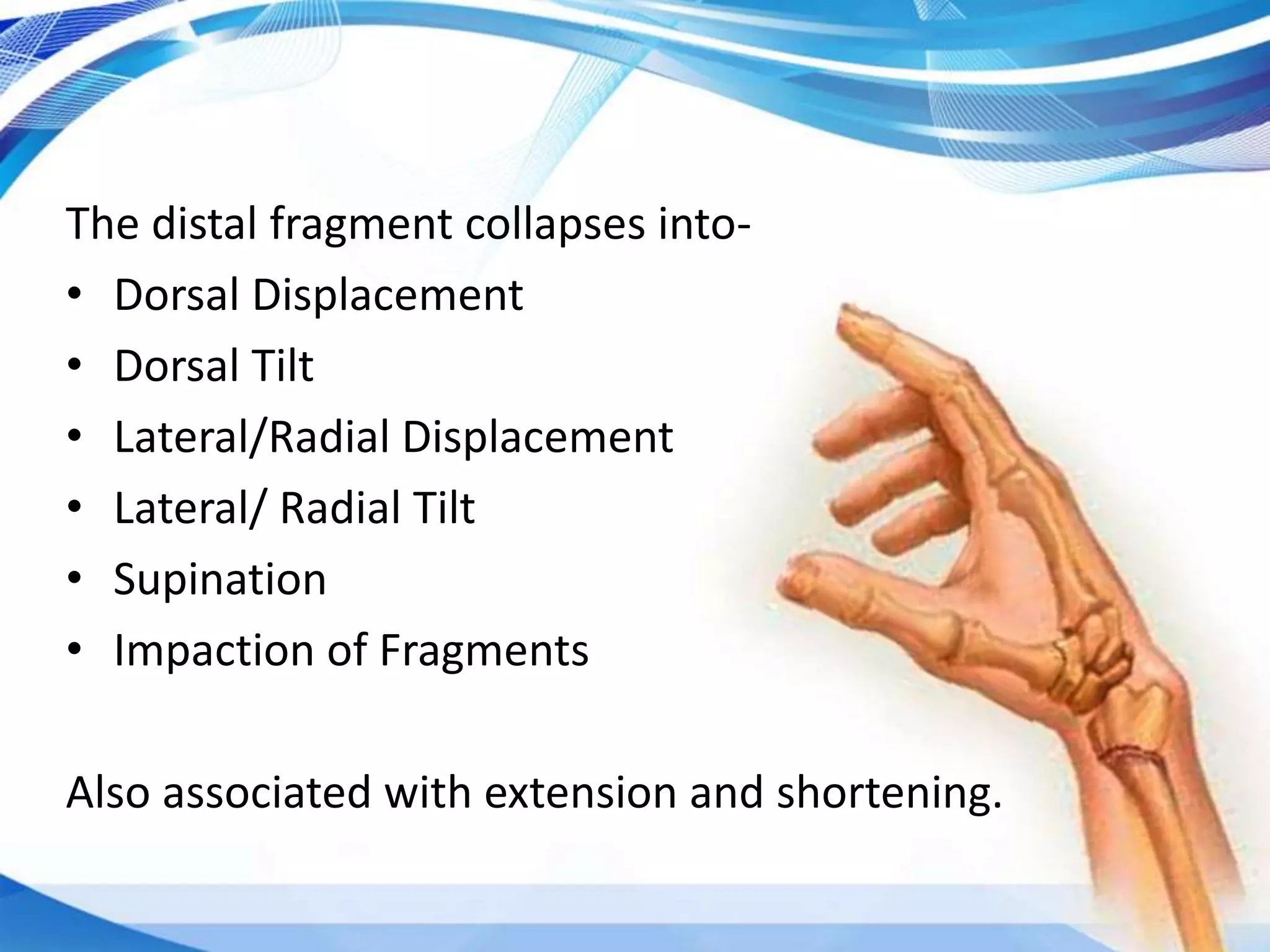 Distal End Radius Fractures - Colles, Smiths & Bartons | PPTX