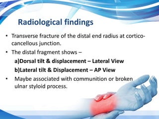 Distal End Radius Fractures - Colles, Smiths & Bartons | PPTX
