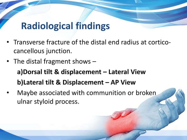 Distal End Radius Fractures - Colles, Smiths & Bartons | PPTX