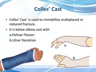 Distal End Radius Fractures - Colles, Smiths & Bartons | PPTX