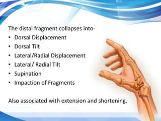 Distal End Radius Fractures - Colles, Smiths & Bartons | PPTX
