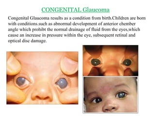 Glaucoma, a major cause of blindness. | PPTX