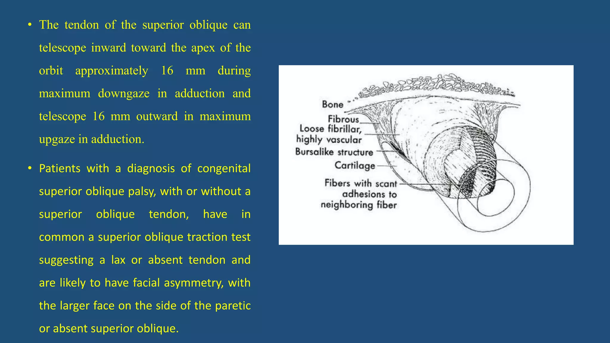 Anatomy of eye and its clinical relevance in Squint | PPTX