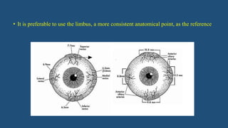 Anatomy of eye and its clinical relevance in Squint | PPTX