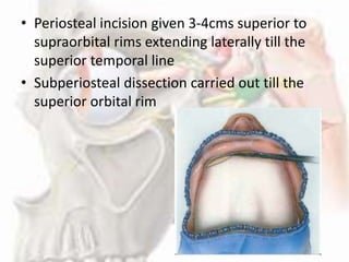 Surgical Anatomy of Orbit | PPTX