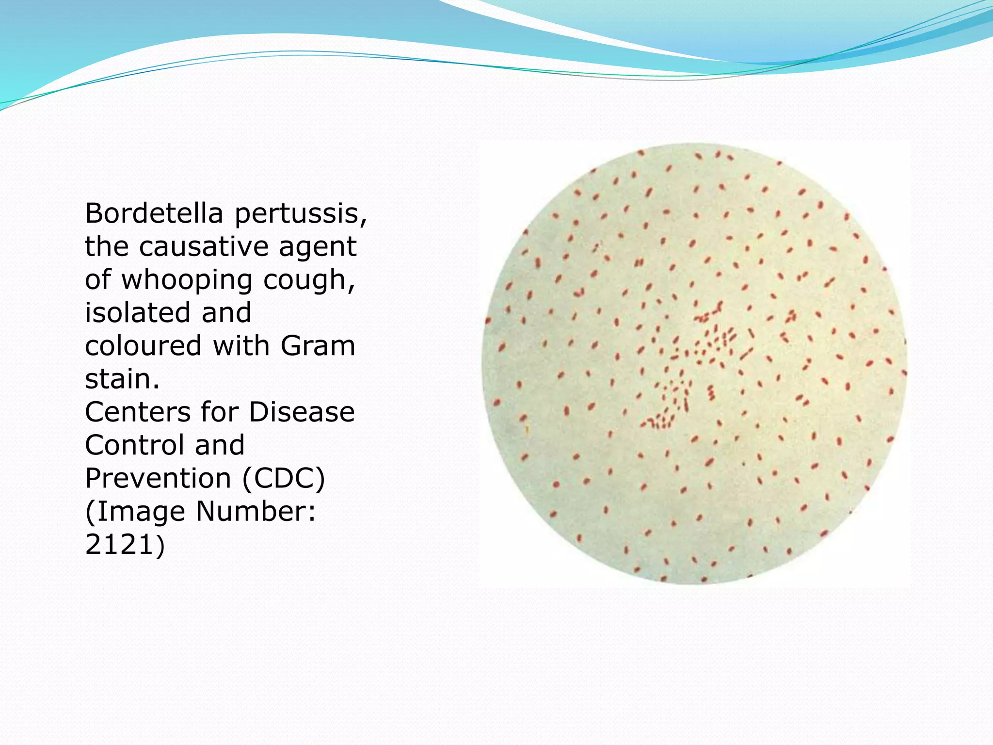 BORDETELLA PERTUSSIS | PPTX