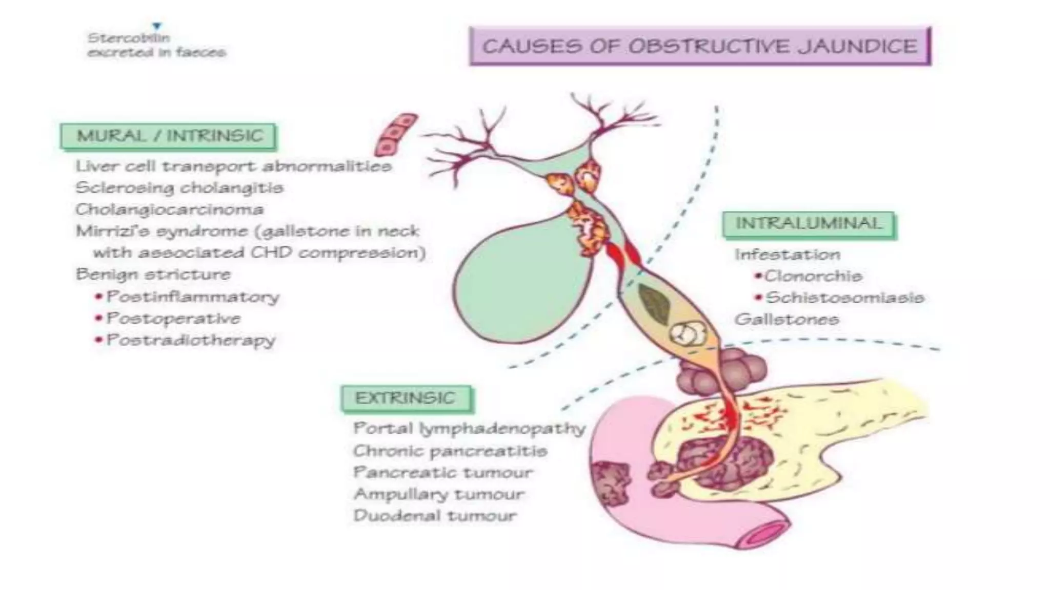 Types of jaundice and etiology of obstructive jaundice | PPT