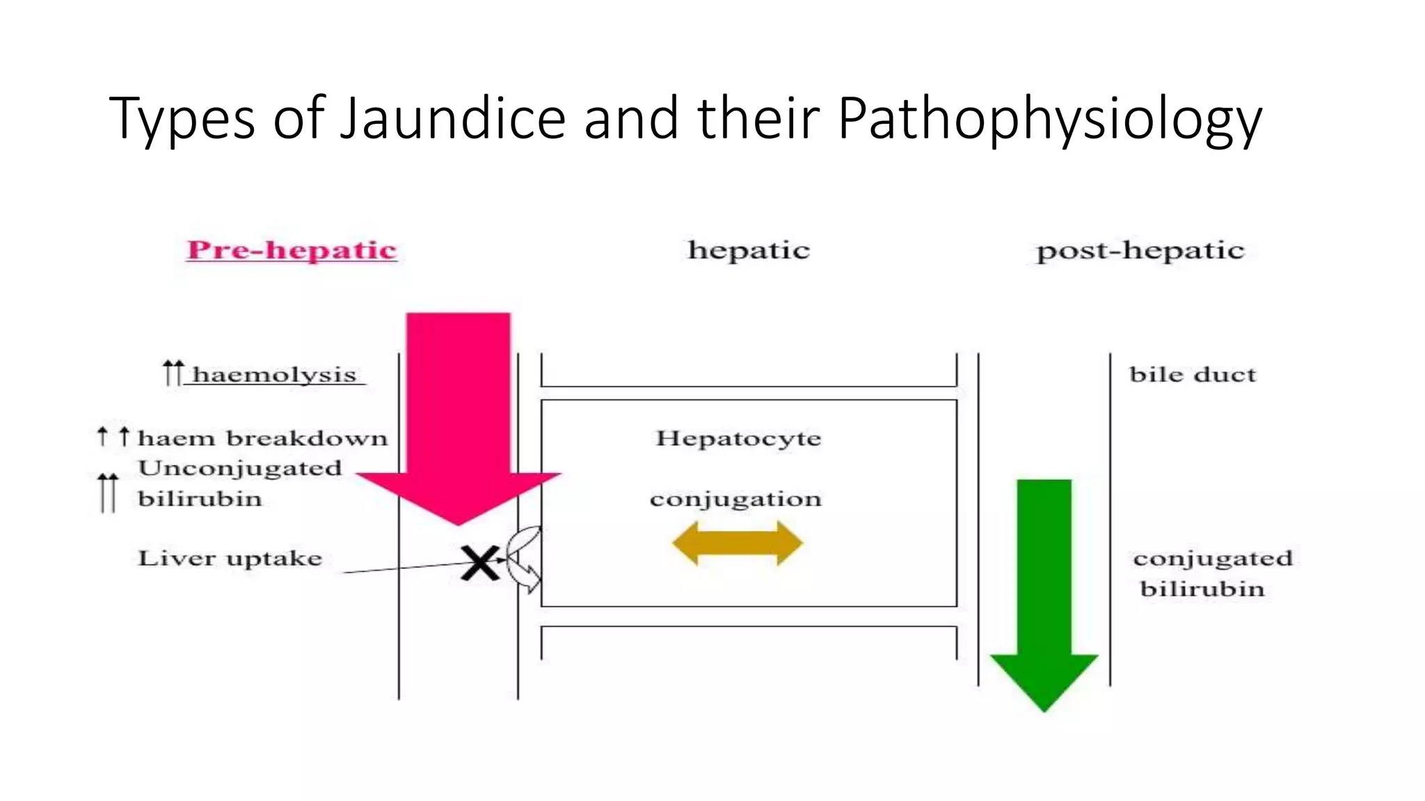 Types of jaundice and etiology of obstructive jaundice | PPT