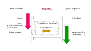 Types of jaundice and etiology of obstructive jaundice | PPTX
