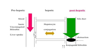 Types of jaundice and etiology of obstructive jaundice | PPTX