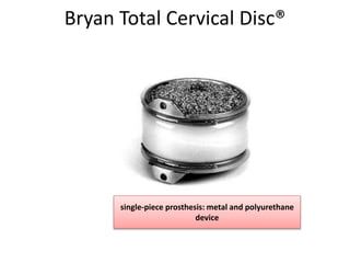 Artificial disc replacement vs ACDF | PPTX