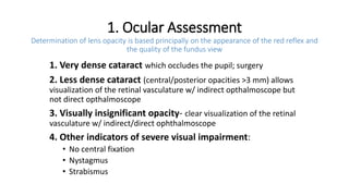 Congenital Catarct | PPTX