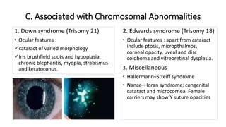 Congenital Catarct | PPTX