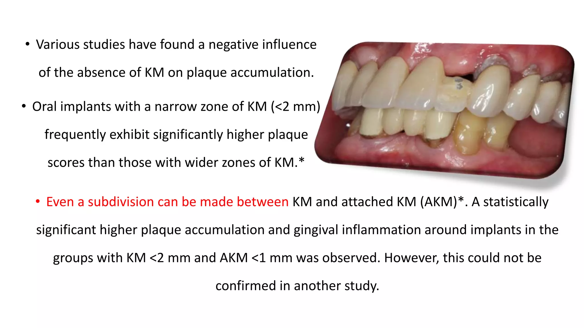 L-PRF for increasing the width of keratinized mucosa around implants: A ...