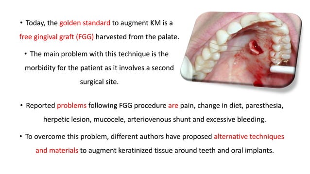 L-PRF for increasing the width of keratinized mucosa around implants: A ...