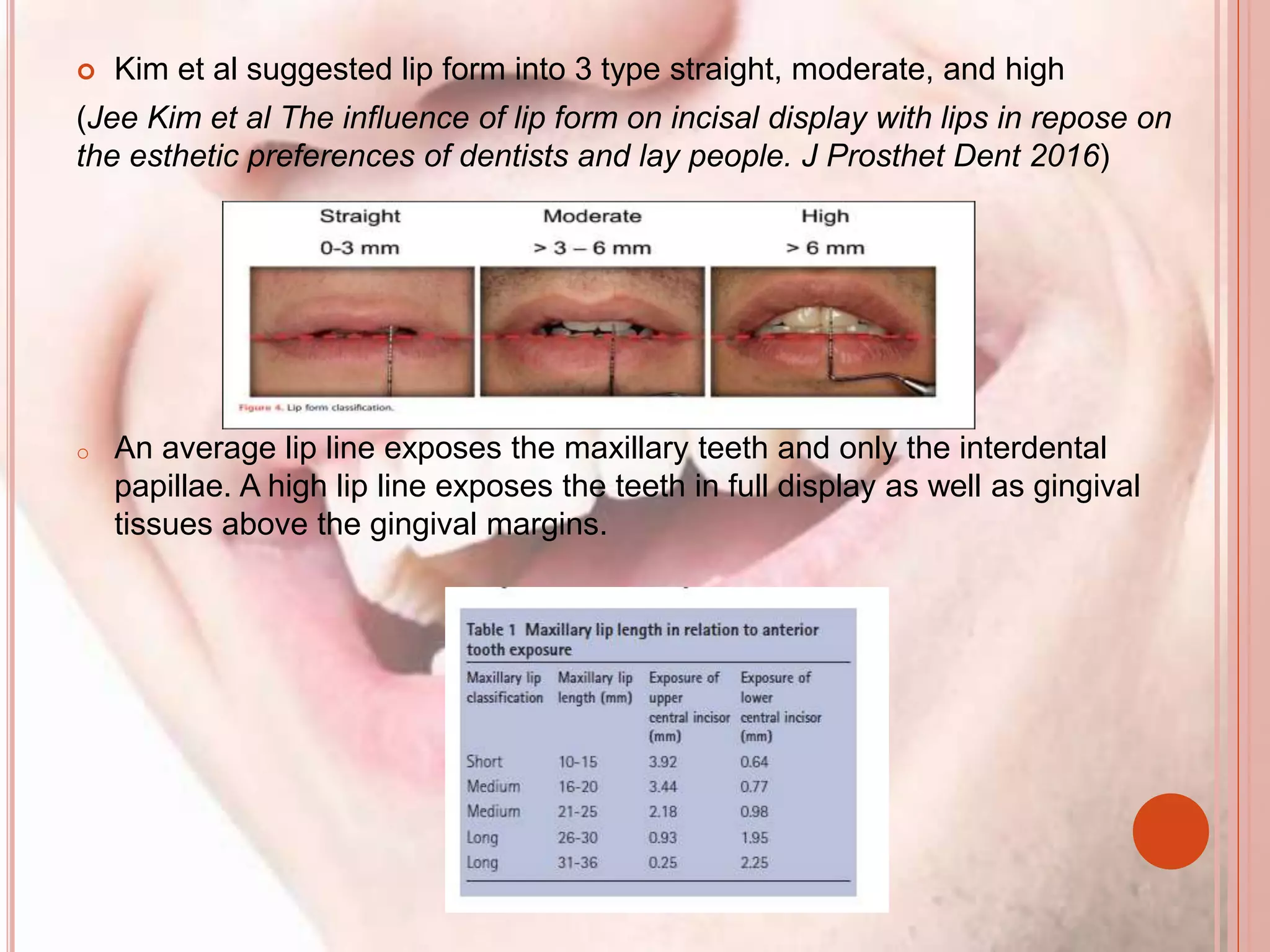 Smile Designing | PPTX