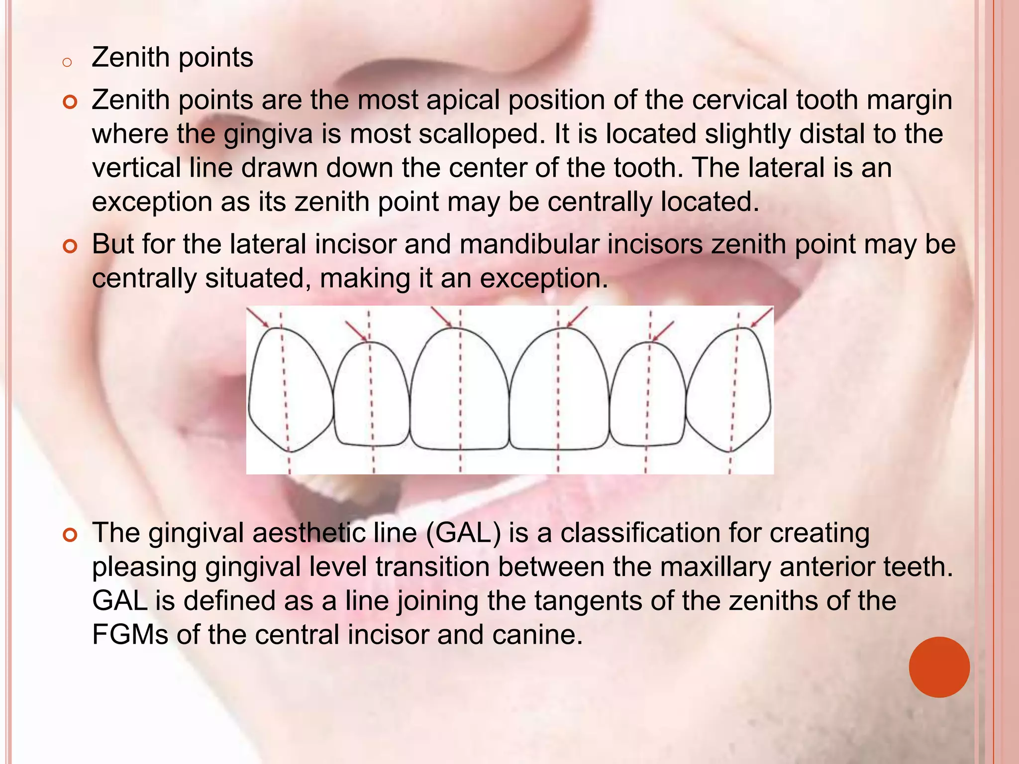 Smile Designing | PPTX
