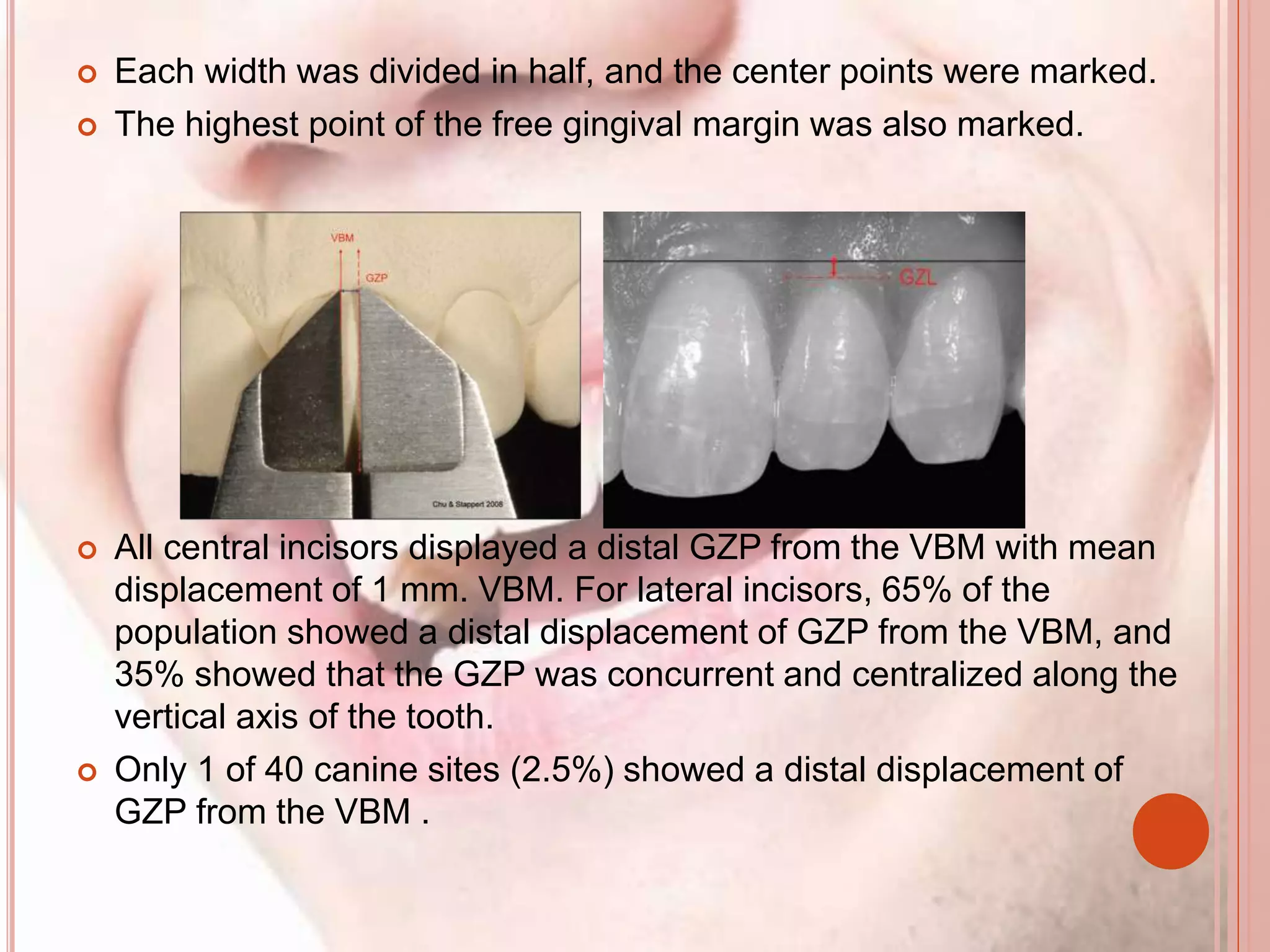 Smile Designing | PPTX
