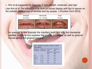 Smile Designing | PPTX