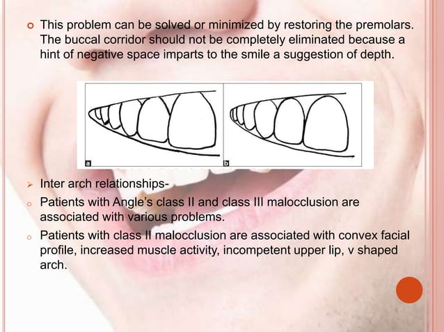 Smile Designing | PPTX | Oral care | Personal Care