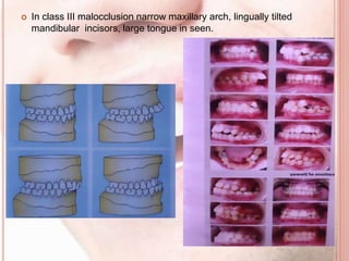 Smile Designing | PPTX
