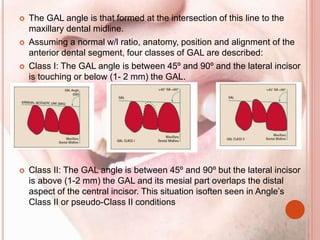 Smile Designing | PPTX