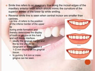 Smile Designing | PPTX