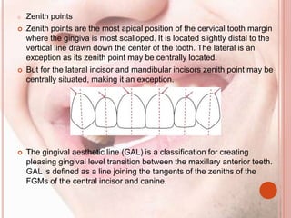 Smile Designing | PPT