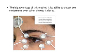 EYE TRACKING TECHNOLOGY | PPTX